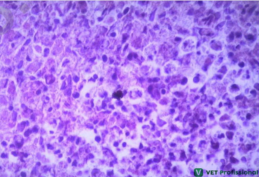 Necrose celular: qual a diferença entre a necrose coagulativa e a ...