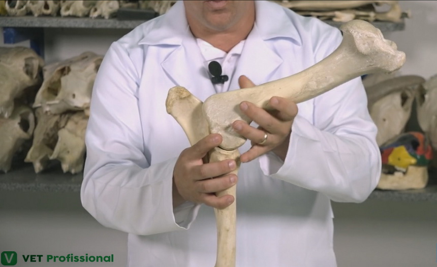 Osso Do Umero Humano