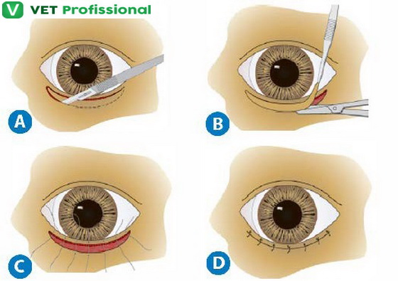 Técnica de Hotz-Celsus para entrópio de pálpebra inferior central ...
