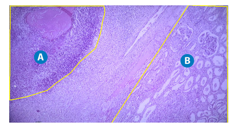 Cerebro De Necrose De Liquefacao Você Sabe Qual A Diferença Entre Um
