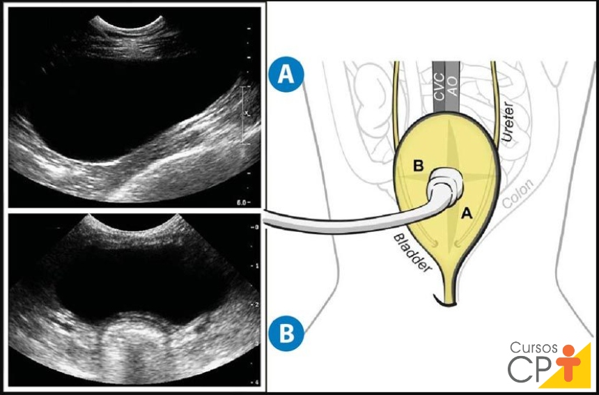 Como é a radiografia e a ultrassonografia da bexiga dos cães e gatos? | Cursos a Distância CPT